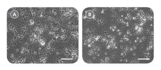 BrainPhys Neuronal Medium for Improved Neuronal Function | Axion Biosystems